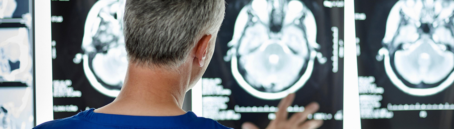 Multiple Sclerosis Current Research | North Bristol NHS Trust